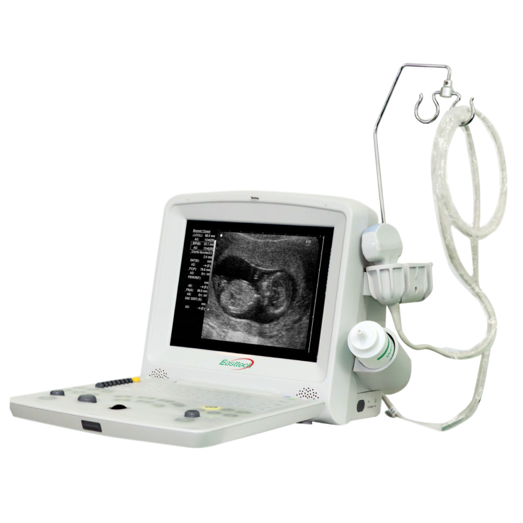 Cardiovascular Color Doppler Ultrasound System Ec100a Pt Karya Pratama